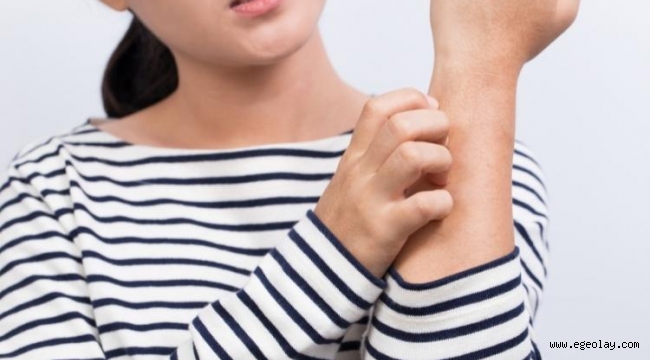 Kaşıntı Neden Olur? Kaşıntıya Ne İyi Gelir? - Sağlık - Ege Olay Gazetesi